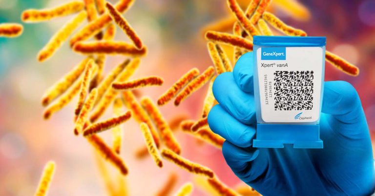 GeneXpert MTB/XDR - Referencia Laboratorio Clínico