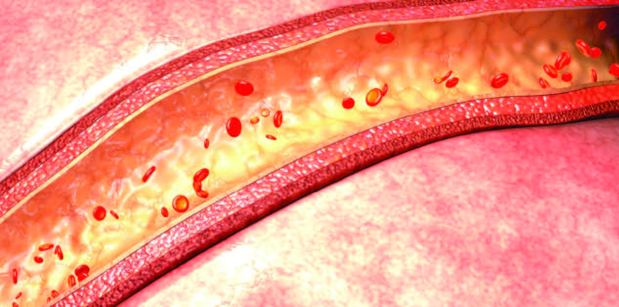 PANEL VASCULITIS Referencia Laboratorio Clínico